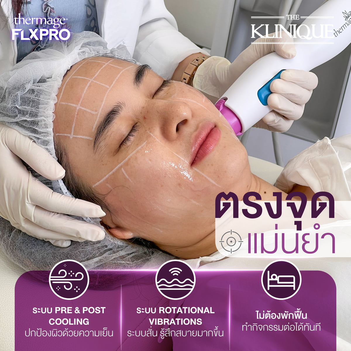แมงปอ ชลธิชาเกือบไปผ่าตัดกระพุ้งแก้ม! ดีนะมาเจอ Thermage FLX PRO ที่ ...