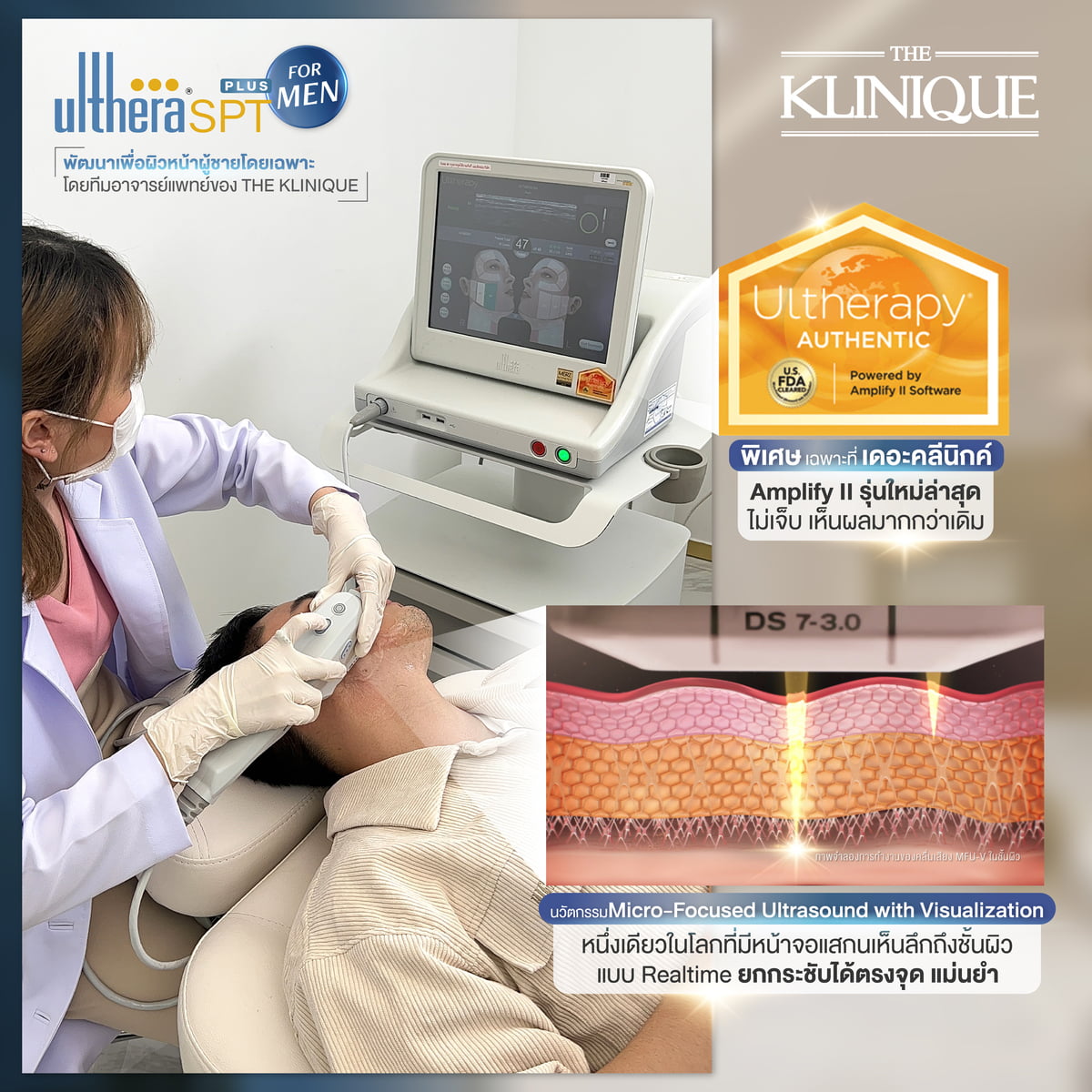 Ulthera ราคาเท่าไหร่ อยากยกกระชับด้วย Ulthera ทำที่ไหนดี - theklinique