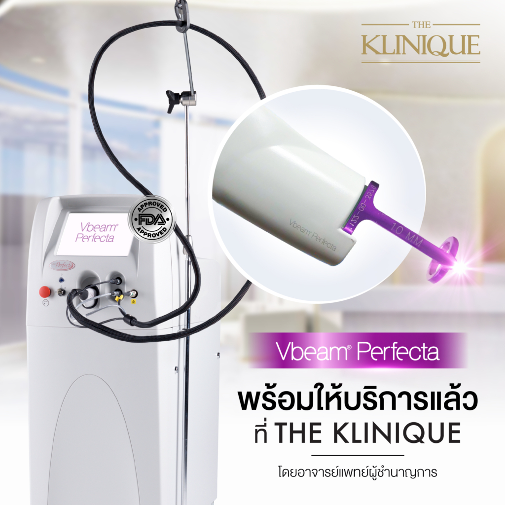 VBeam® Perfecta เทคโนโลยีรักษารอยแดงพัฒนาใหม่รุ่นล่าสุด ที่ THE ...