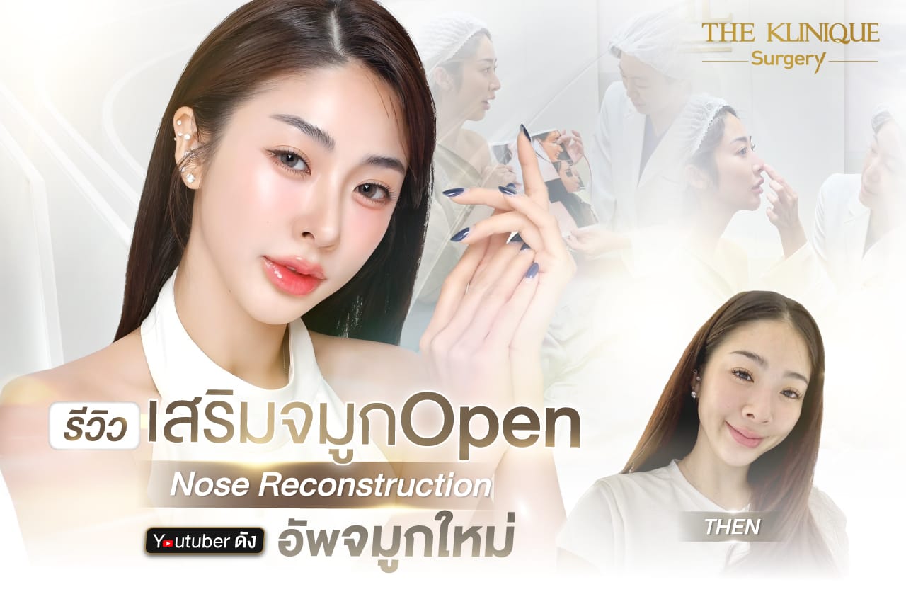 รีวิวจมูกโอเพ่น(Open) น้องแนน Youtuber อัพจมูกอีกครั้ง