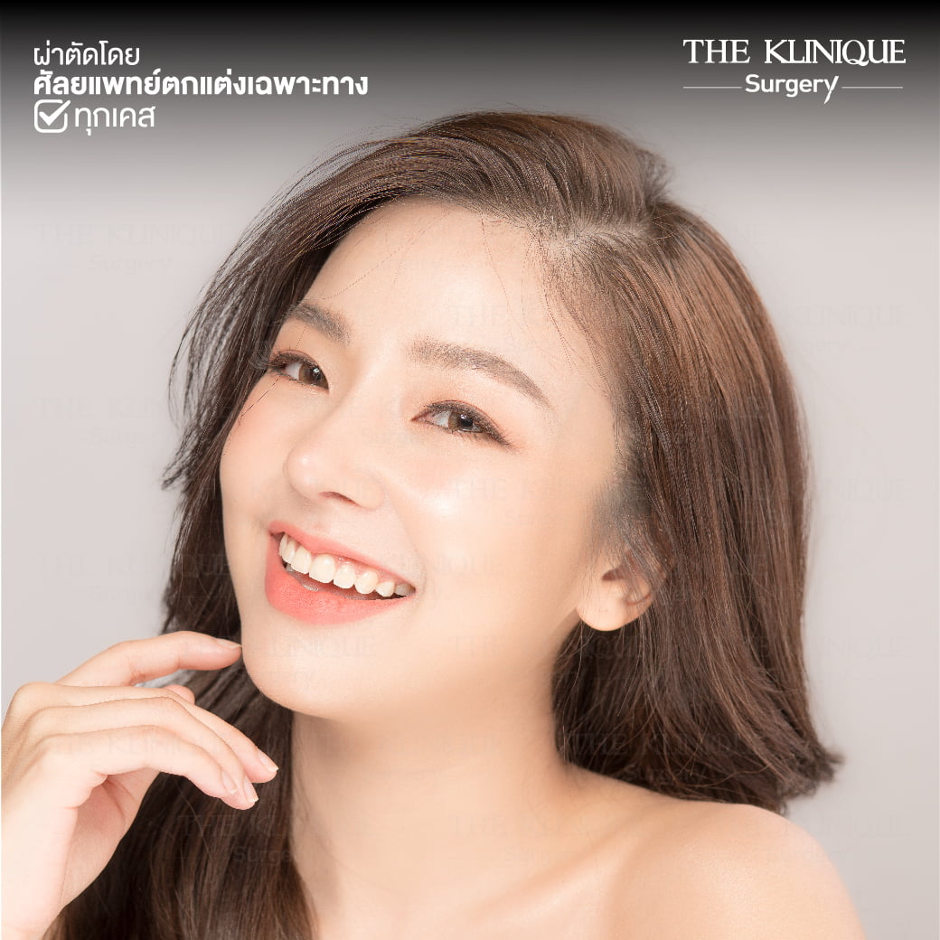 รวม รีวิวเสริมจมูกโอเพ่น (Open) ทรงจมูกเกาหลี By หมอคิม - theklinique