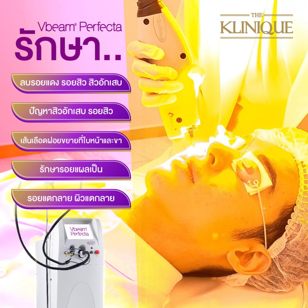 VBeam Laser รักษาปานแดงแต่กำเนิดได้จริงหรือ? - theklinique
