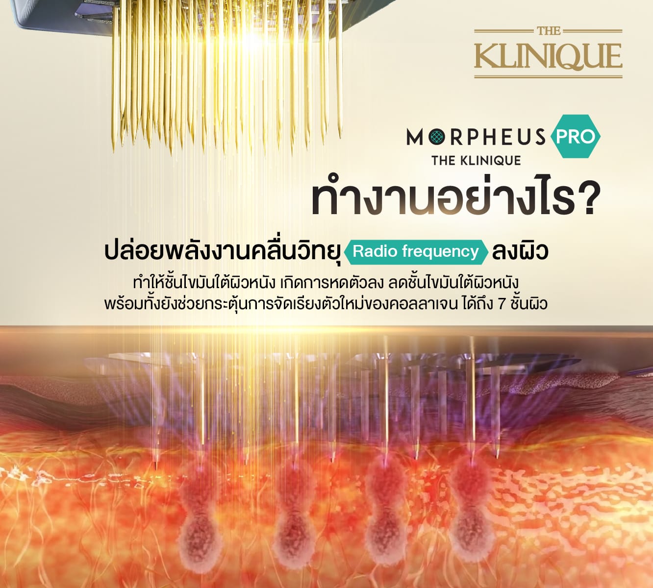 Morpheus PRO นวัตกรรมเย็บผิวเหี่ยว กู้ผิวยับ - theklinique