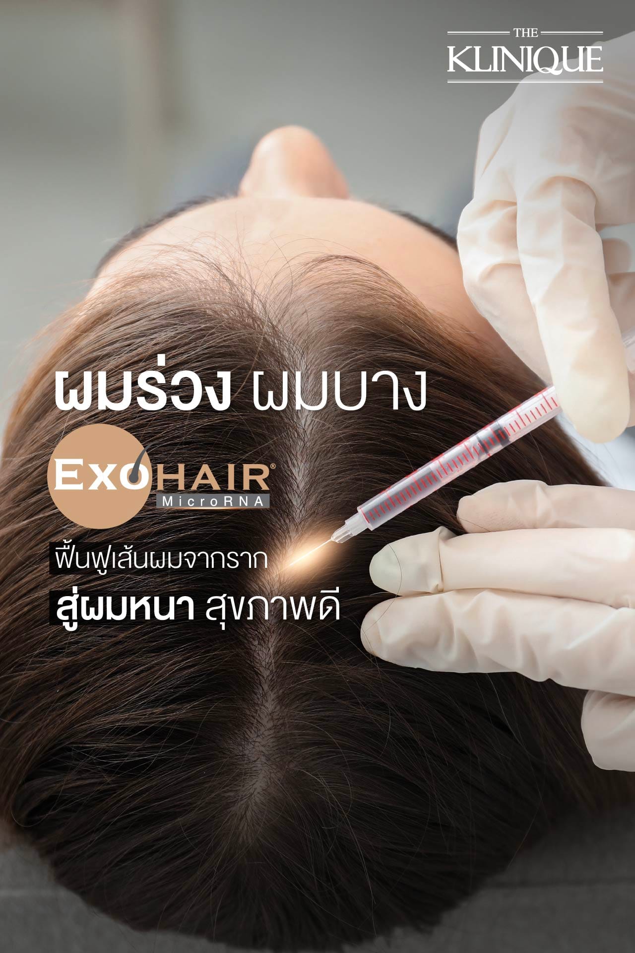 Exo Hair Micro RNA ฟื้นฟูเส้นผมจากราก สู่ผมหนา สุขภาพดี - theklinique