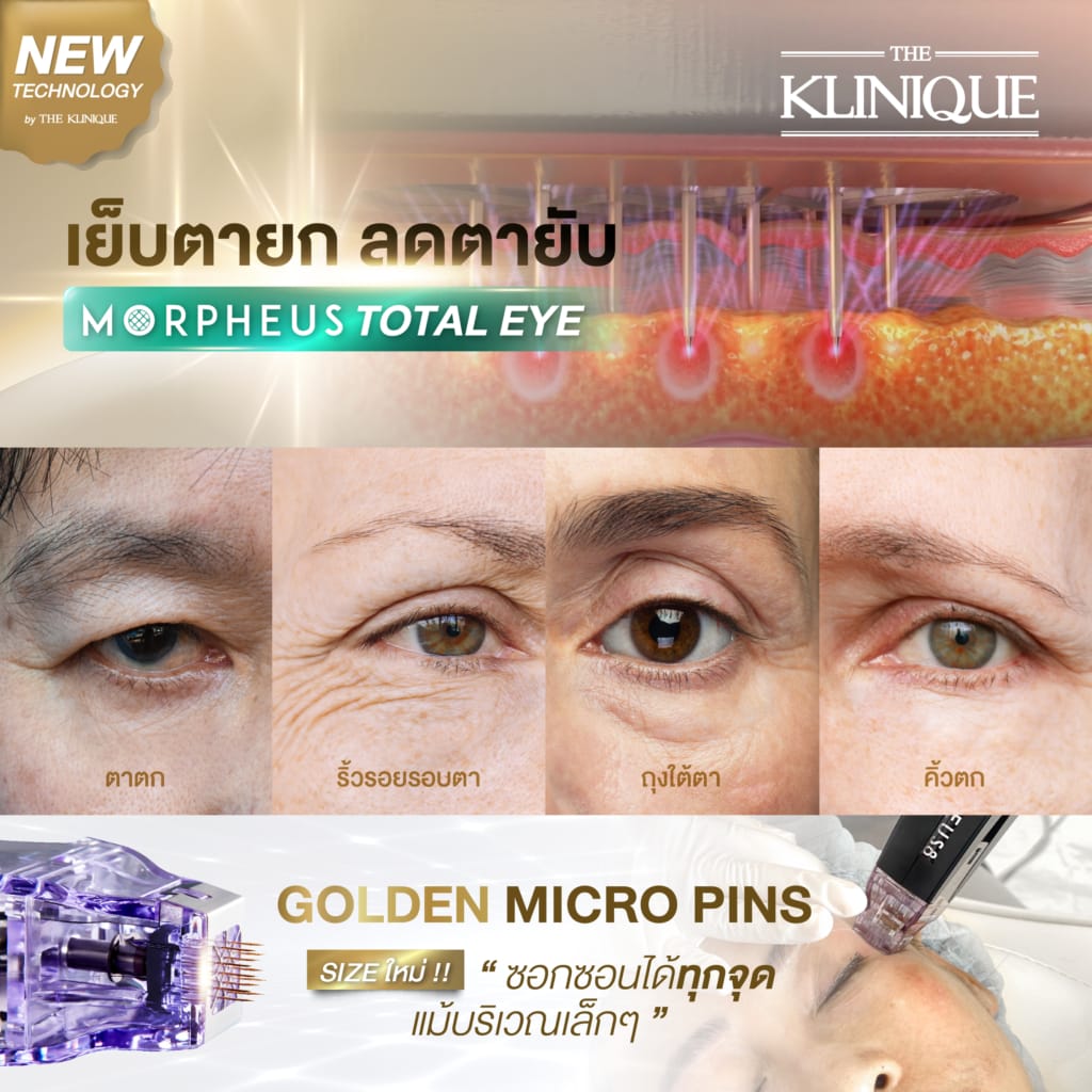 Morpheus Total Eye ดูแลผิวรอบดวงตา ลดรอยยับ ดึงคิ้วตึง ยกหางตาเฉี่ยว ...