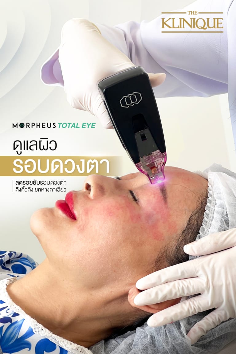 Morpheus Total Eye ดูแลผิวรอบดวงตา ลดรอยยับ ดึงคิ้วตึง ยกหางตาเฉี่ยว ...
