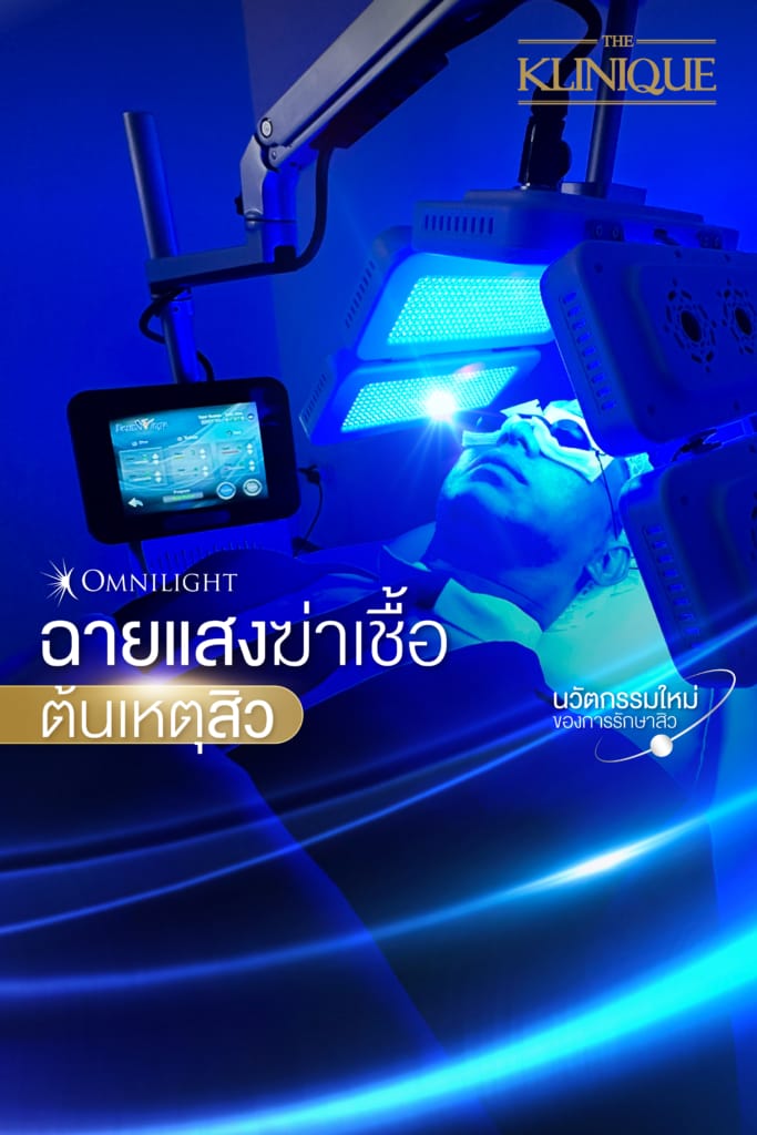 OMNILIGHT ฉายแสงฆ่าเชื้อต้นเหตุสิว นวัตกรรมใหม่ของการรักษาสิวด้วยแสง ...