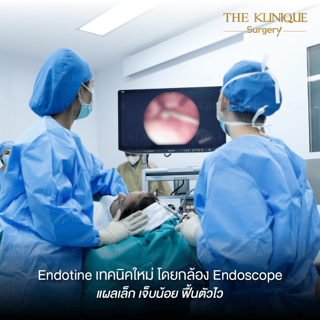 Endotine ยกระชับยกผิวหน้า แก้ปัญหาหน้าผากย่น คิ้วตก หางตาตก - theklinique