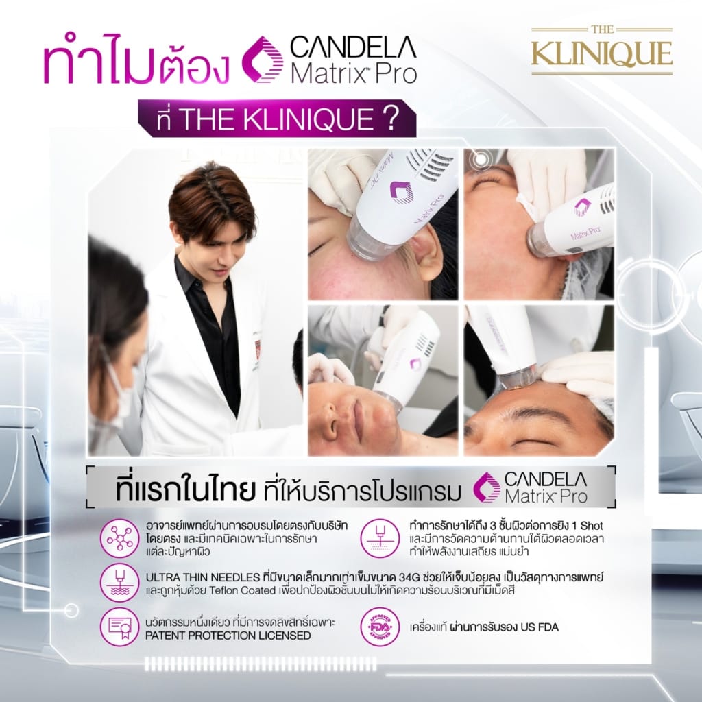 Candela Matrix PRO #เลเซอร์งานผิวAI ติดฟิลเตอร์ให้ผิวสวยกริบด้วย ...