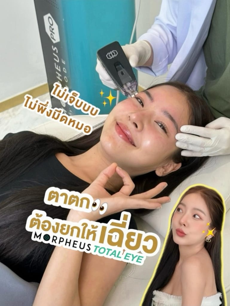 Morpheus Total Eye แก้ตาตก ยกตาเฉี่ยว - theklinique