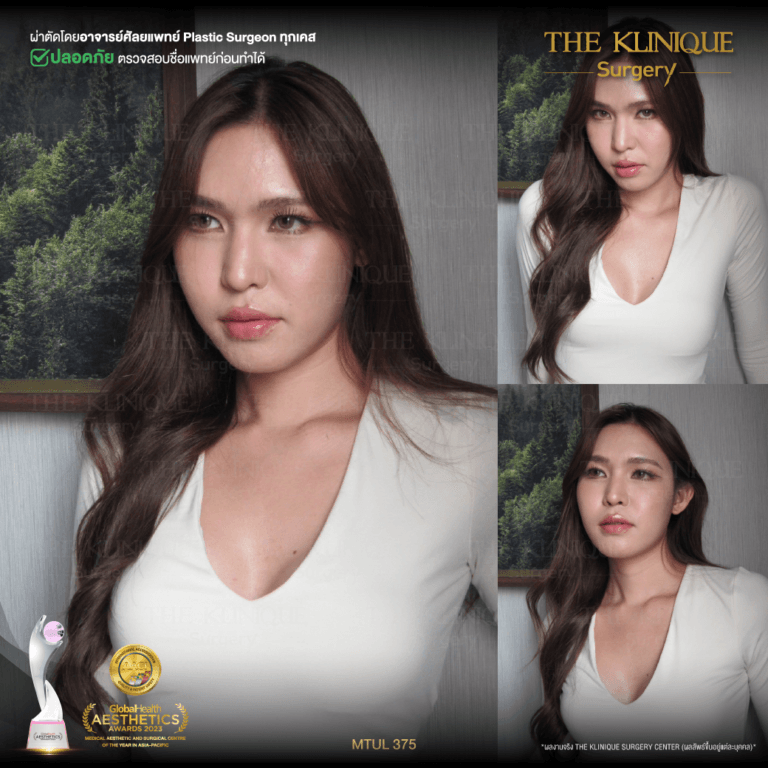 เสริมหน้าอก เลือกซิลิโคนแบบไหนดี Motiva หรือ Mentor - theklinique