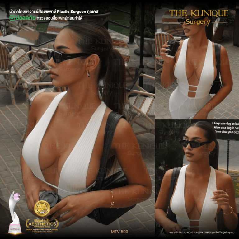 เสริมหน้าอก เลือกซิลิโคนแบบไหนดี Motiva หรือ Mentor - theklinique