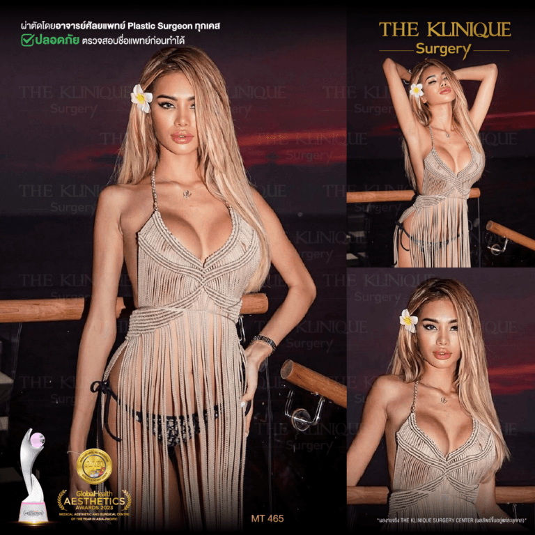 เสริมหน้าอก เลือกซิลิโคนแบบไหนดี Motiva หรือ Mentor - theklinique