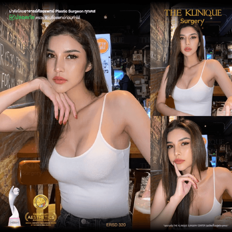 เสริมหน้าอก เลือกซิลิโคนแบบไหนดี Motiva หรือ Mentor - theklinique