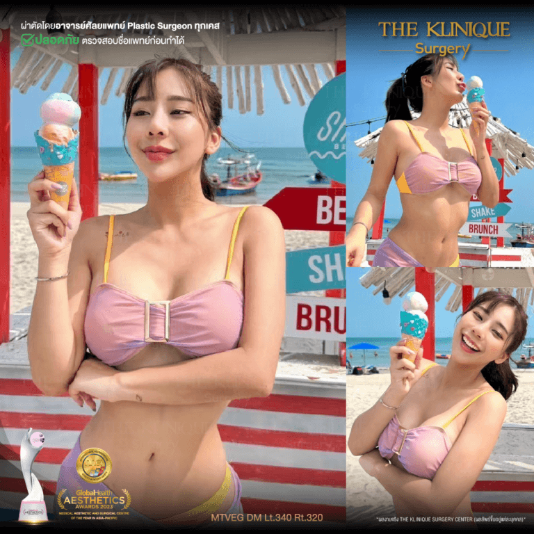 เสริมหน้าอก เลือกซิลิโคนแบบไหนดี Motiva หรือ Mentor - theklinique