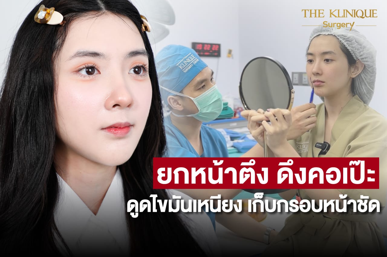 รีวิว ดูดไขมันเหนียง หน้าเรียวเล็ก กรอบหน้าชัด