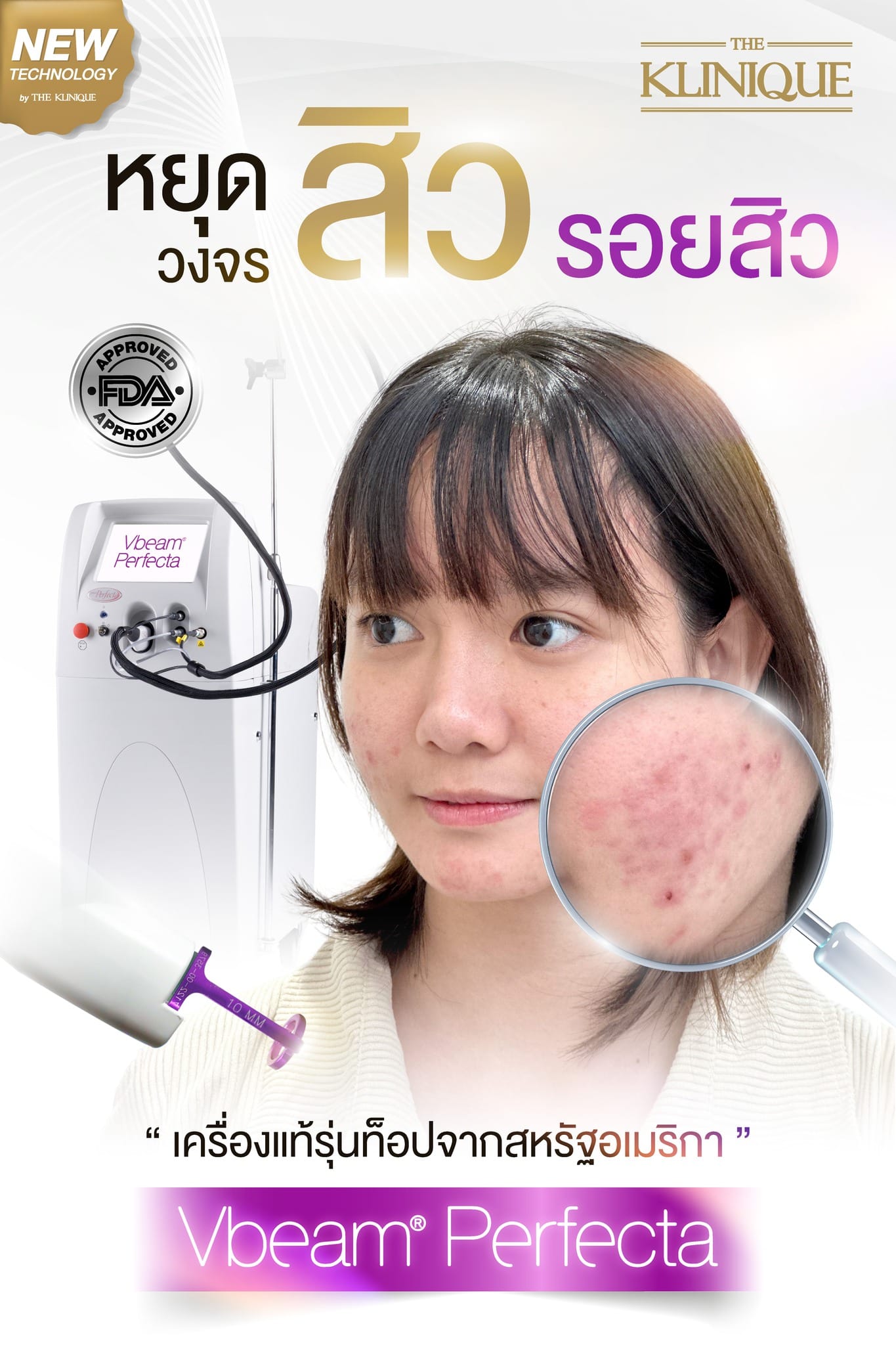 ลบรอยแดง รักษารอยสิวด้วย V Beam Laser นวัตกรรมเลเซอร์รักษาผิวจบทุกปัญหา ...