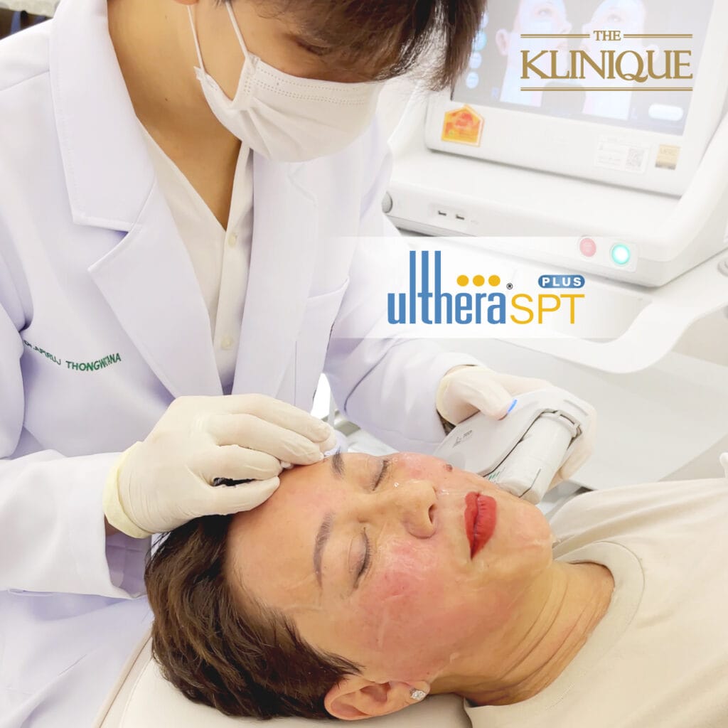 เจาะลึก Ulthera SPT+ ราคาสูงเพราะอะไร? ทำไมต้องทำเครื่องแท้ที่ THE ...