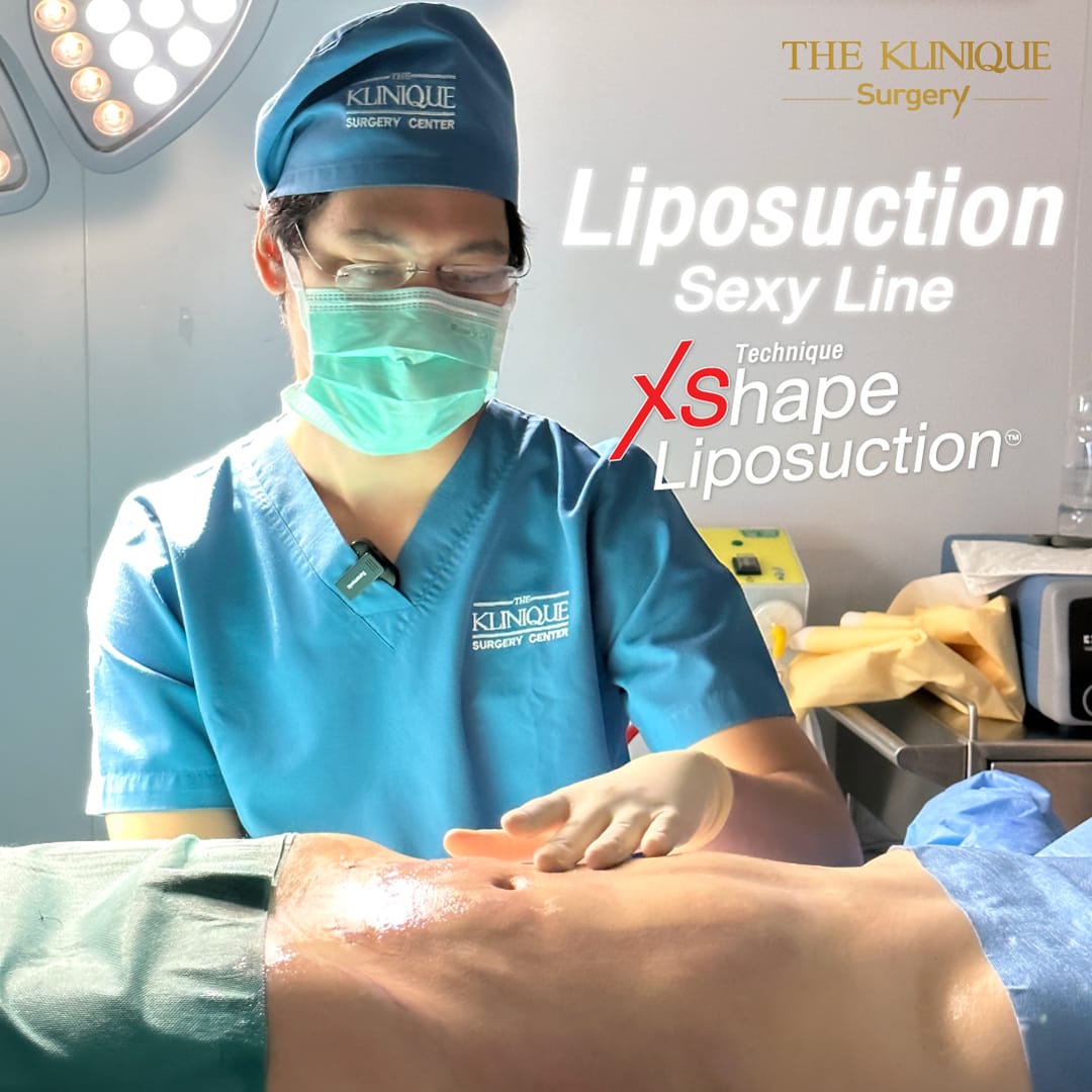 XShape Liposuction Techniques from Dr. Jun