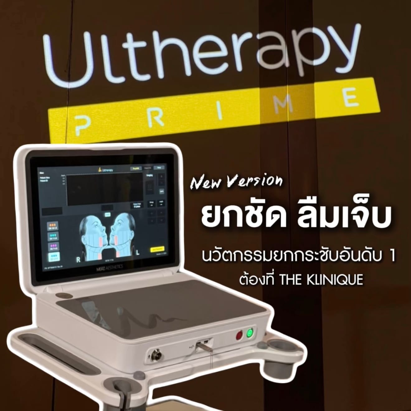 Ultherapy PRIME นวัตกรรมล่าสุดของการยกกระชับ! THE KLINIQUE พาอัปเดตก่อนใคร Ulthera รุ่นใหม่ดี ...