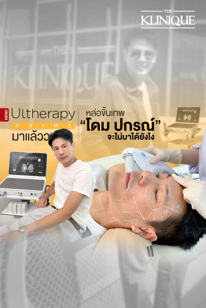ยกชัด ลืมเจ็บ อยู่นาน NEW! Ultherapy PRIME มาแล้วว หล่อขั้นเทพ “พี่โดม ...