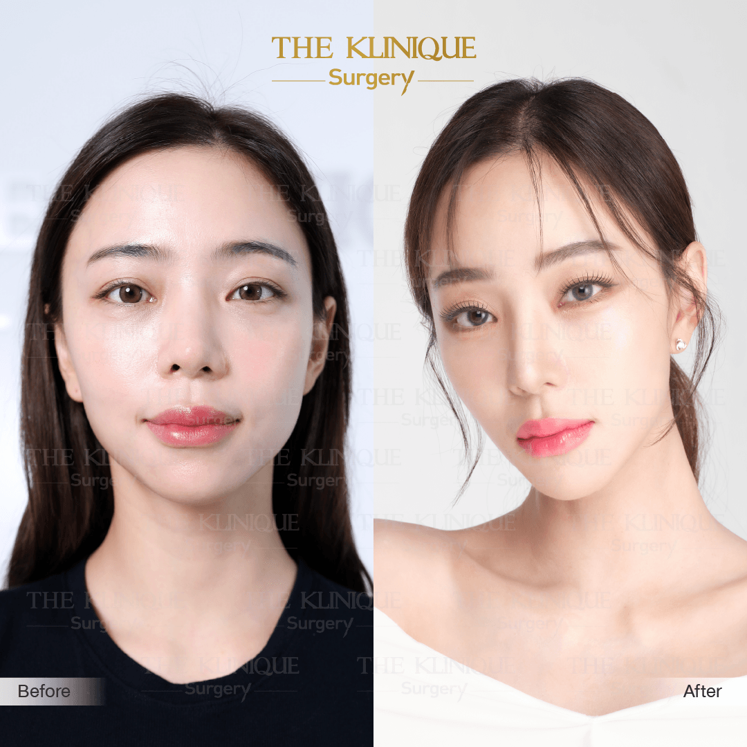 หมอดึงหน้าดารา Dr.Aun ศัลยแพทย์ตกแต่งเฉพาะทาง