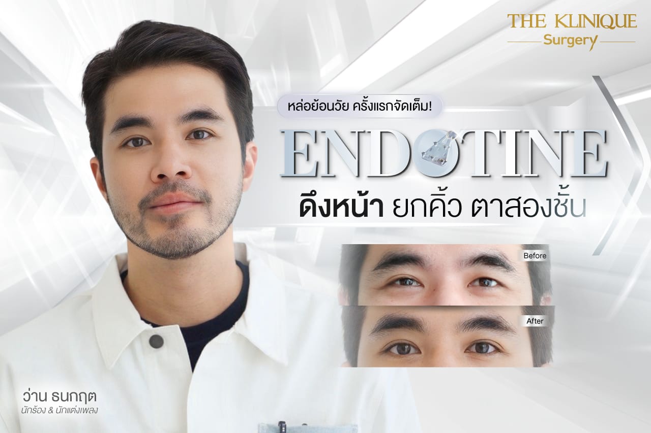 เปิด รีวิวดึงหน้าEndotine ศัลยกรรมตาสองชั้น ครั้งแรกของ ว่าน ธนกฤต