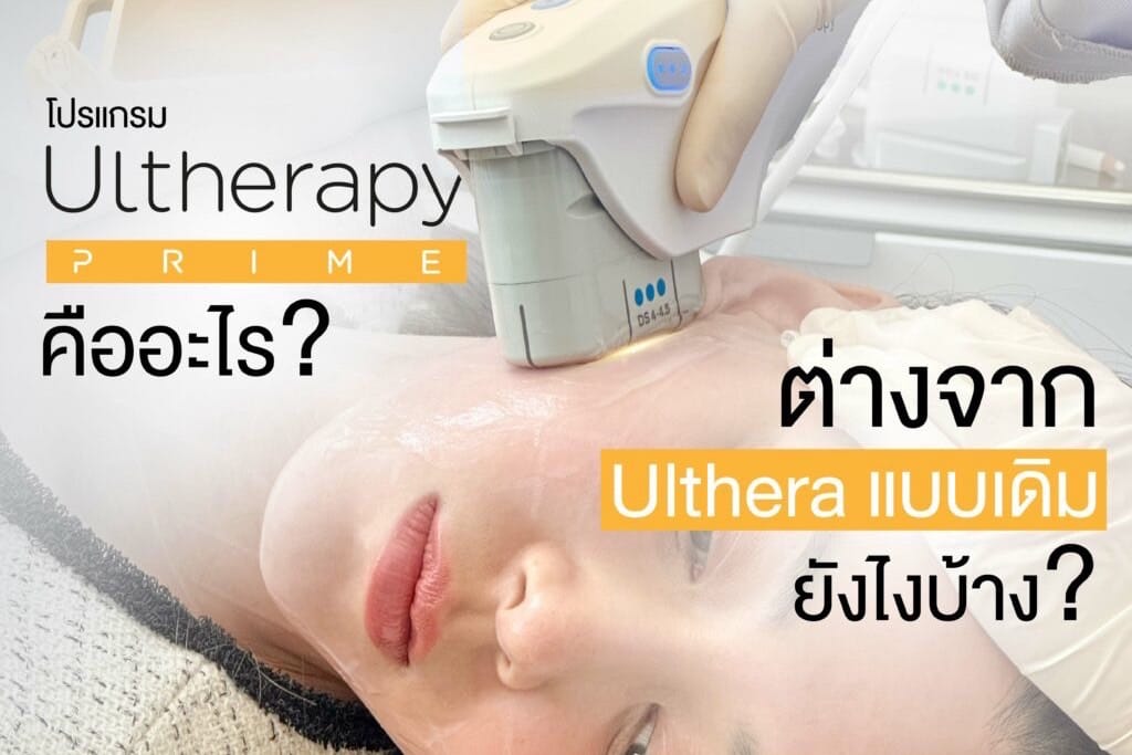 โปรแกรม Ultherapy PRIME คืออะไร? ต่างจาก Ulthera แบบเดิมยังไงบ้าง ...