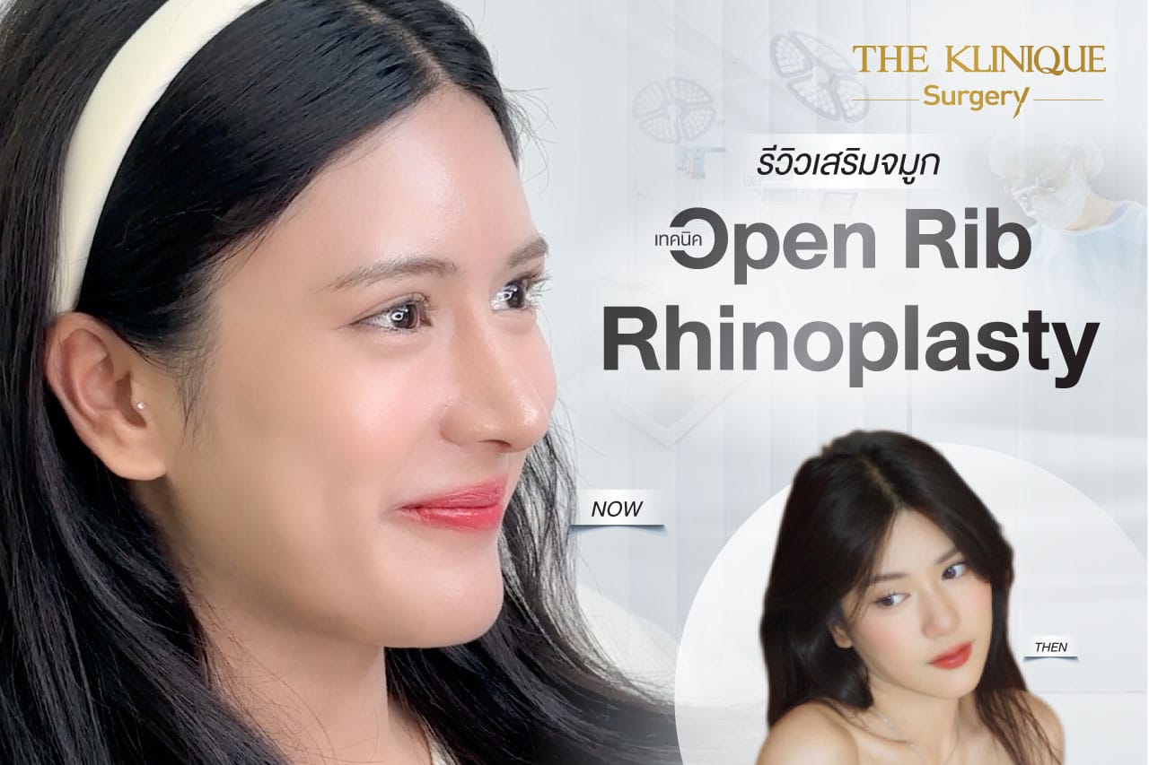 รีวิวจมูกOpen คุณเรนเดียร์ (ลำเจียก) ทรงสวย หวานละมุน
