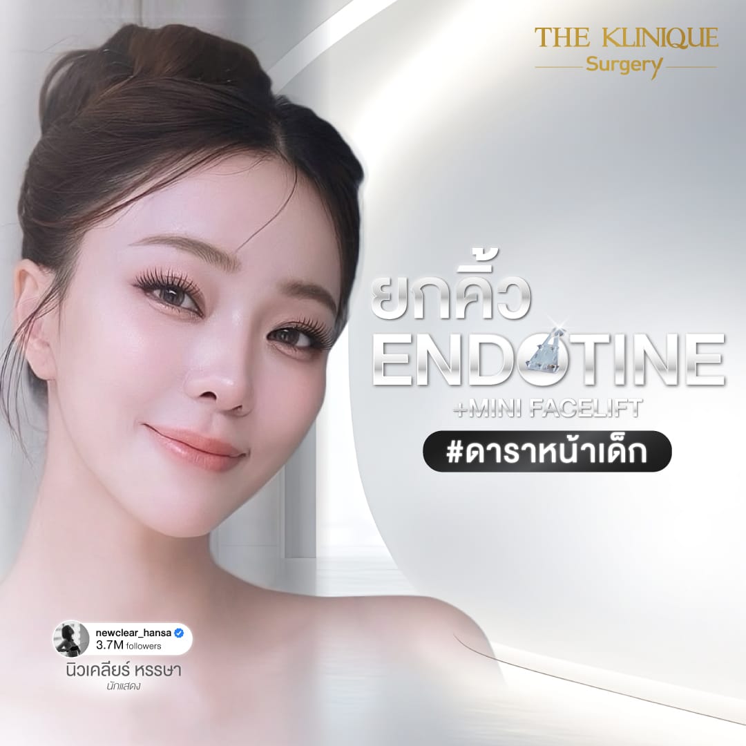 รีวิวสุดจึ้ง Endotine + Mini Facelift ดึงหน้า ยกคิ้ว เทคนิคเกาหลี ครบ 1 ปี