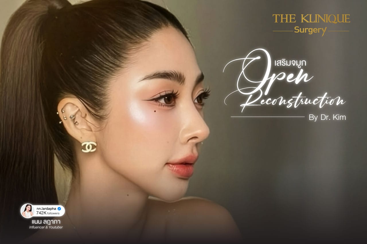 Update ความปัง หลังเสริมจมูก Open Reconstruction ครบ 2 ปี